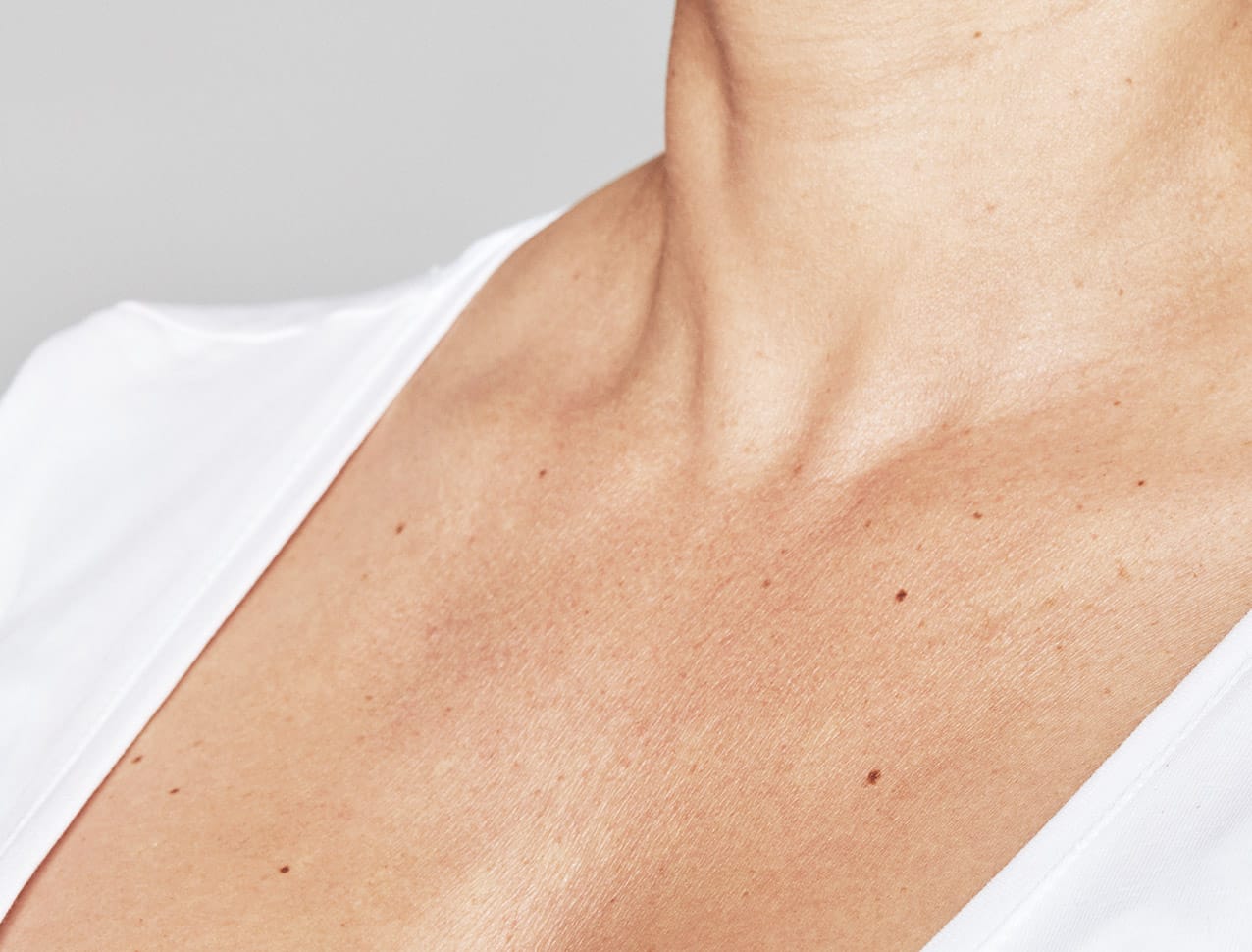 Decolletage Wrinkle Treatment | Restylane® Skinboosters™ | Galderma ...