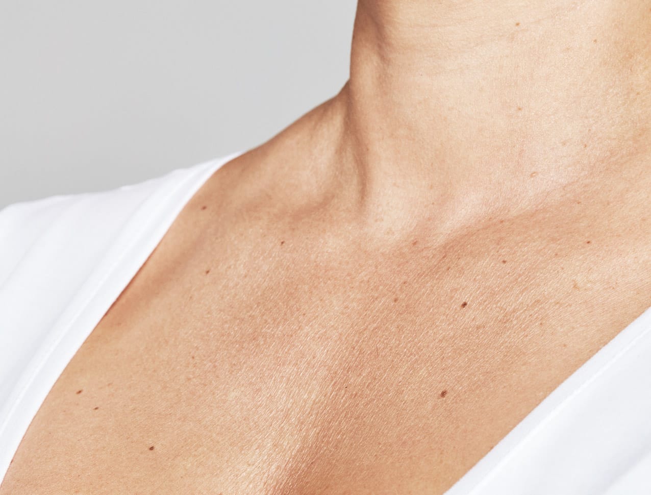 Decolletage Wrinkle Treatment | Restylane® Skinboosters™ | Galderma ...